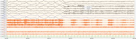 is multiple line chart with drawing tools possible with plotly js plotly js plotly