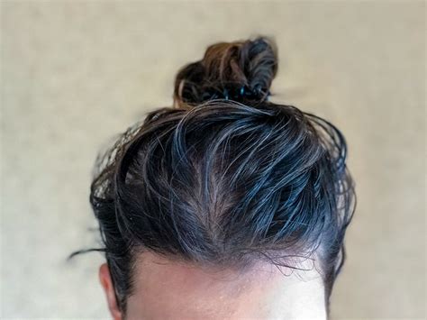 Oily Scalp Causes Treatment And Prevention What You Need To Know