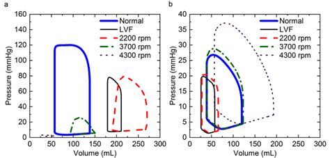 The A Left Ventricular P V Loop And B Right Ventricular P V Loop Download Scientific