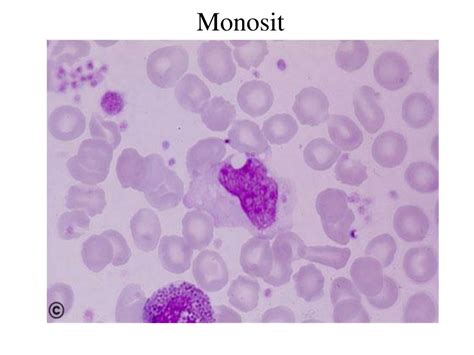 Ppt Kemİk İlİĞİ Ve Perİferİk Yayma Örneklerİ Powerpoint Presentation