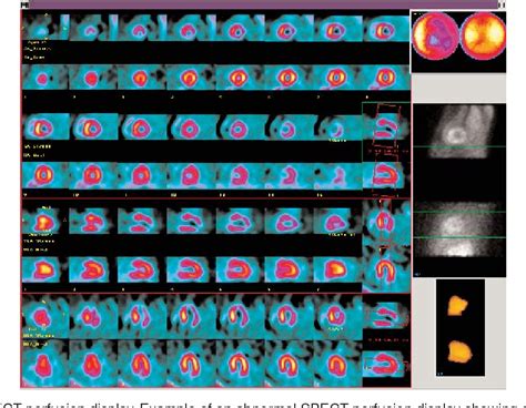 Figure 2 From Acc Aha Asnc Guidelines For The Clinical Use Of Cardiac