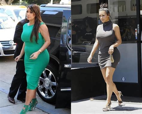Kim Plastic Surgery Before And After