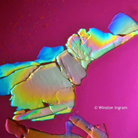 Microscopy Image Gallery Microbus Microscope Educational Website