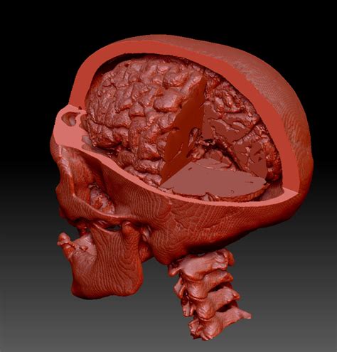 Dicom Data Segmentation For Customized Illustration References Morgan
