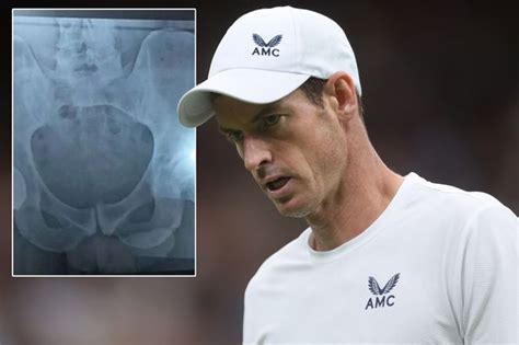 X Ray Which Showed Andy Murrays Penis Turned Into Giant Billboard