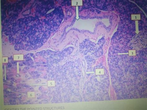 IDENTIFY THE POINTED STRUCTURES Chegg