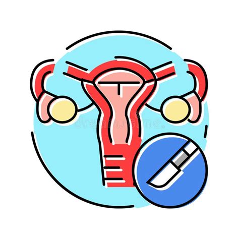 Tubal Ligation Surgery Color Icon Vector Illustration Stock