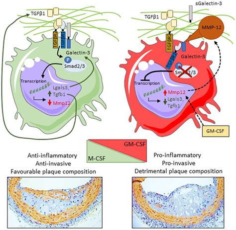 Galectin 3 Identifies A Subset Of Macrophages With A Potential