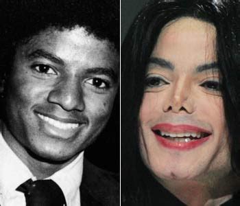 Michael Jackson Plastic Surgery Before And After Nose Jobs And Skin Tone Star Plastic Surgery