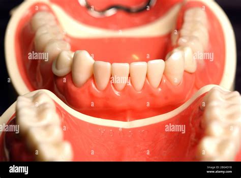 Close Up Of A Set Of Dentures Dentures Or False Teeth Are Made From An