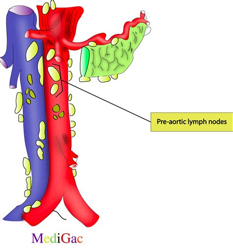 What Are The Lymph Nodes Of The Abdomen Medigac