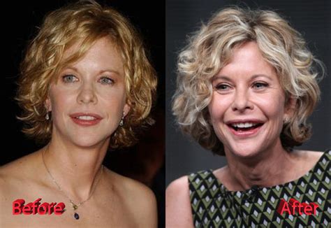 Meg Ryan Before Heres How Meg Ryan Looked Before And After Her