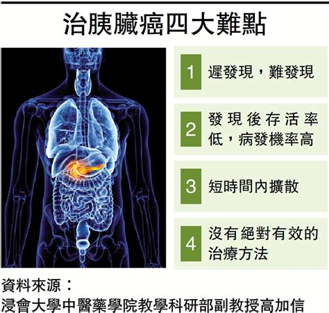 沉默殺手胰臟癌難發現 死亡率逾九成 大公報