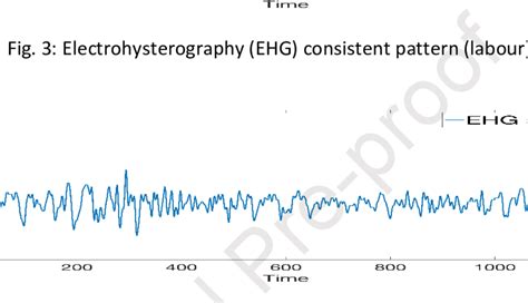 Electrohysterography Ehg Random Pattern Non Labour Download Scientific Diagram