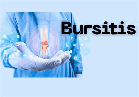 Bursitis Types Symptoms Treatment And Prevention Joints Health Hub