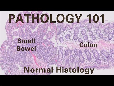 Normal Duodenum Histology Normal Duodenum Histology