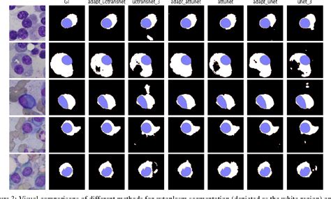 Figure 3 From Boosting Medical Image Segmentation Performance With Adaptive Convolution Layer