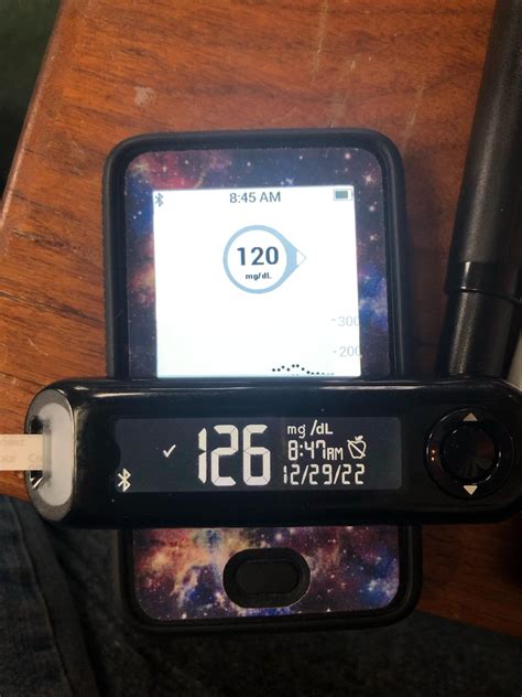 Reusing Dexcom Sensor R Diabetes