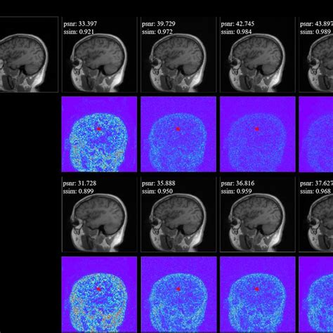Example Reconstruction Results Of The Different Methods At Two Download Scientific Diagram