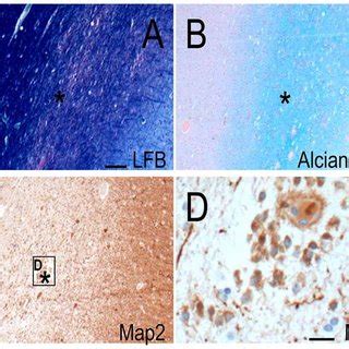 The Temporal Cortex Of Case 2 The Cortical Lamination Of The Temporal Download Scientific