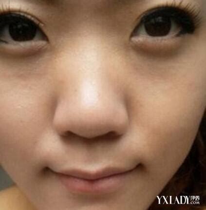 女人蒜头鼻面相好不好相关阅读 女人蒜头鼻面相好不好在线阅读 周易算命网