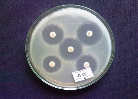Antimicrobial Susceptibility Of S Typhi Download Scientific Diagram