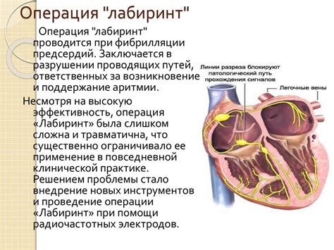 Операции на сердце презентация онлайн