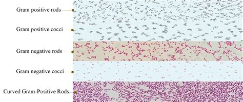 Gram Staining Procedure Principle And Results Biology Notes Online