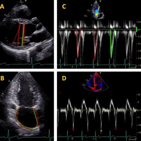 Examples Of Images And Measurements By The Dl Algorithm Green