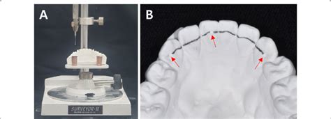 Design Of Lingual Fixed Retainer A Design On One Plane Using Dental Download Scientific