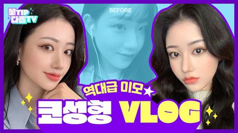 찐후기 코성형 Vlog ｜ 다름성형외과 Youtube