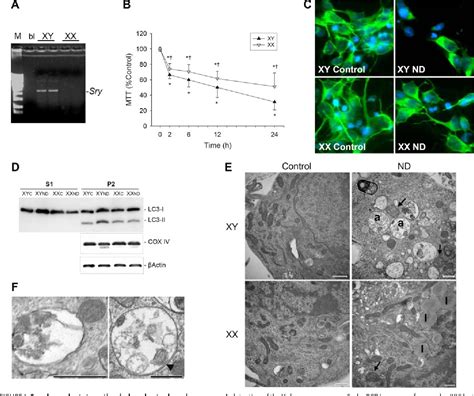 Figure 1 From Gfp Lc 3 Fluorescence Was Enhanced Using Anti Gfp Semantic Scholar