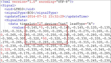 Ecg Data Results With Null Values Stored As An Xml File Download