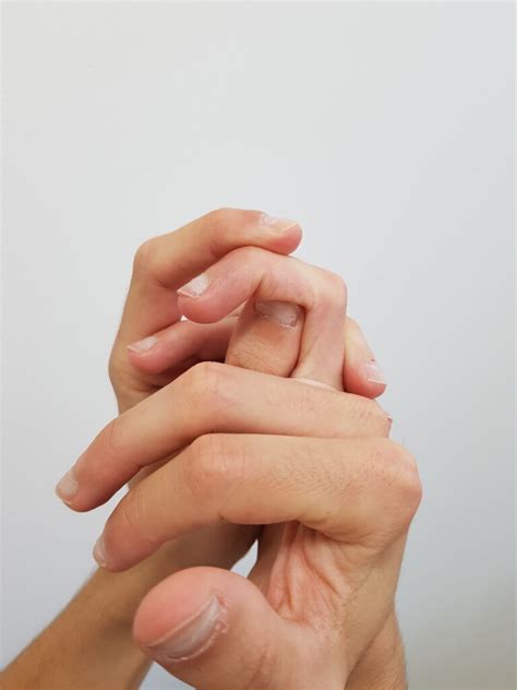 Understanding Pip Joint Stiffness And Its Treatment The Benzema´s