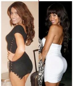 Rosa Acosta Before And After Latintrends