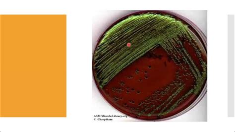 Enterics Part 1 Youtube