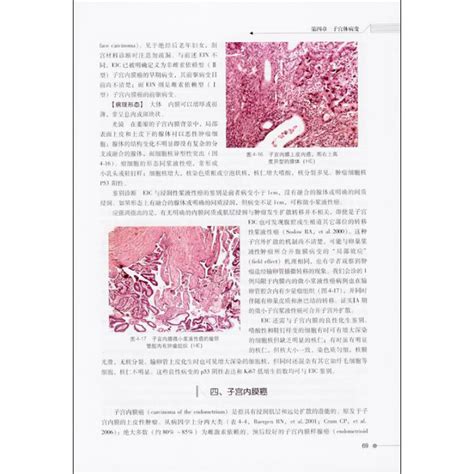 诊断病理学图册 360百科