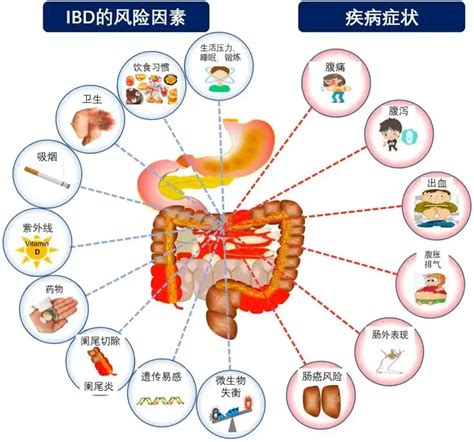 新重疾详解2严重克罗恩病 知乎