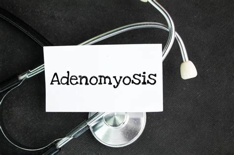 Uterine Adenomyosis Advanced Womens Care