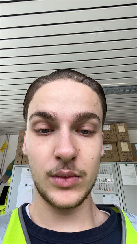 i have a very white skin and blackness around my eyes i also am also always tires and don t