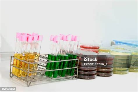 테이블에 미생물의 성장 배양과 페트리 접시 및 테스트 튜브 유리 웨어에서 다채로운 유체 배양 배지 생명 공학 실험실 실험 개념 태국 2019년 11월 7일 0명에 대한 스톡