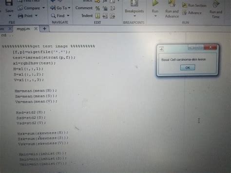 Skin Lesion Classification In Images File Exchange MATLAB Central