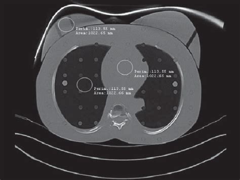 A Ct Scan Image Of The Phantom With ∼100 Mm × 100 Mm Circles Indicating