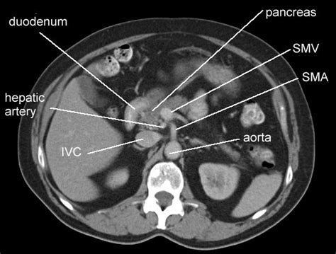 Anatomy Of The Pancreas