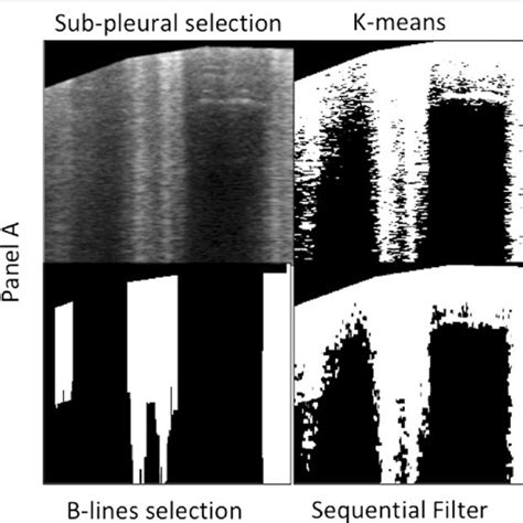 Segmentation Algorithm Basic Steps Upper Left Sub Pleural Selection