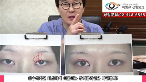 나에게 어울리는 쌍수라인 찾기 Youtube