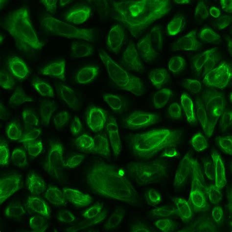 Human Thymic Epithelial Cells Innoprot Adrenal Gland Cell System