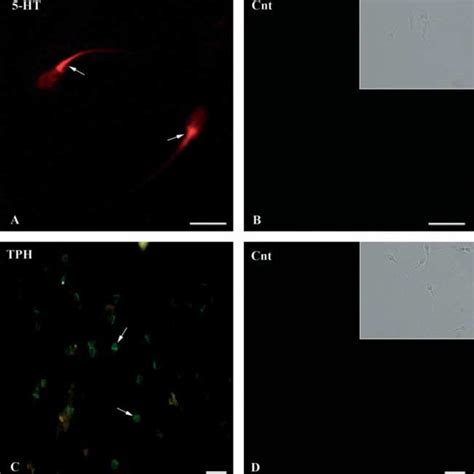 Tryptophan Hydroxylase Activity Monitored Through The Production Of