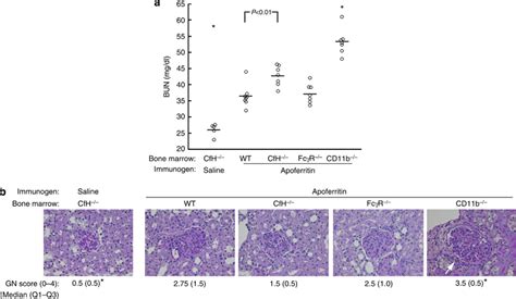 Worsened Glomerulonephritis In Complement Factor H Cfh−− Mice With Download Scientific