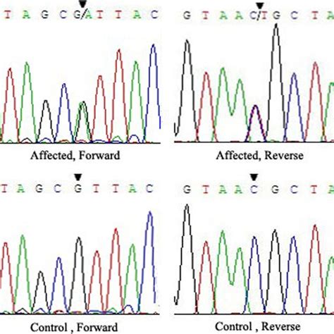 forward and reverse sequence analysis of the affected and unaffected